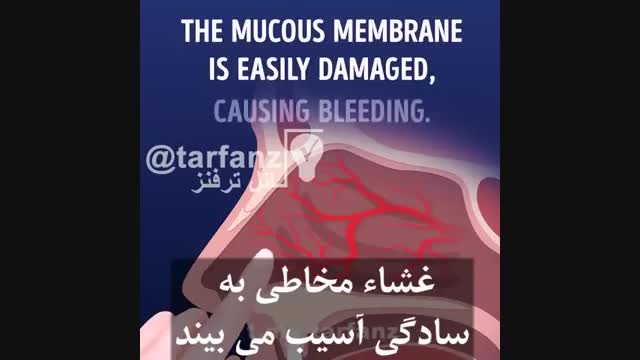 برای چی نباید در دماغ انگشت کنیم؟ دلیلشو در ویدیو ببینید نماشا